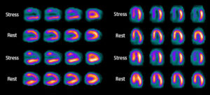 WHAT IS NUCLEAR MEDICINE IMAGING? - Mayfair Diagnostics