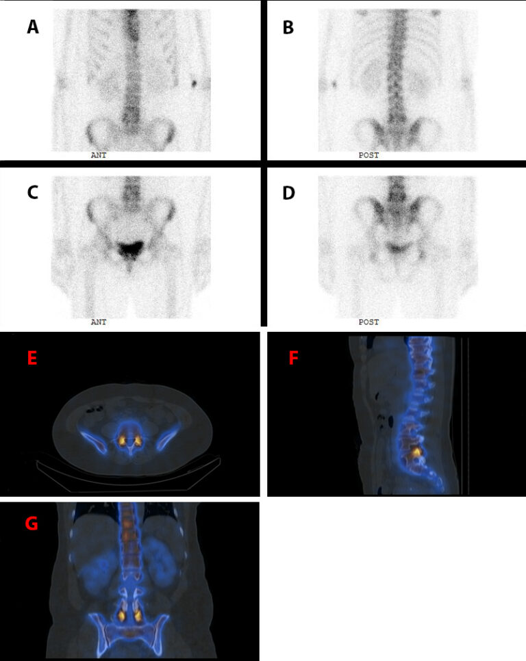 WHAT IS NUCLEAR MEDICINE IMAGING? - Mayfair Diagnostics