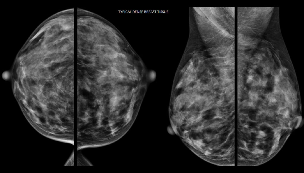 ADVANCES IN BREAST IMAGING - Mayfair Diagnostics