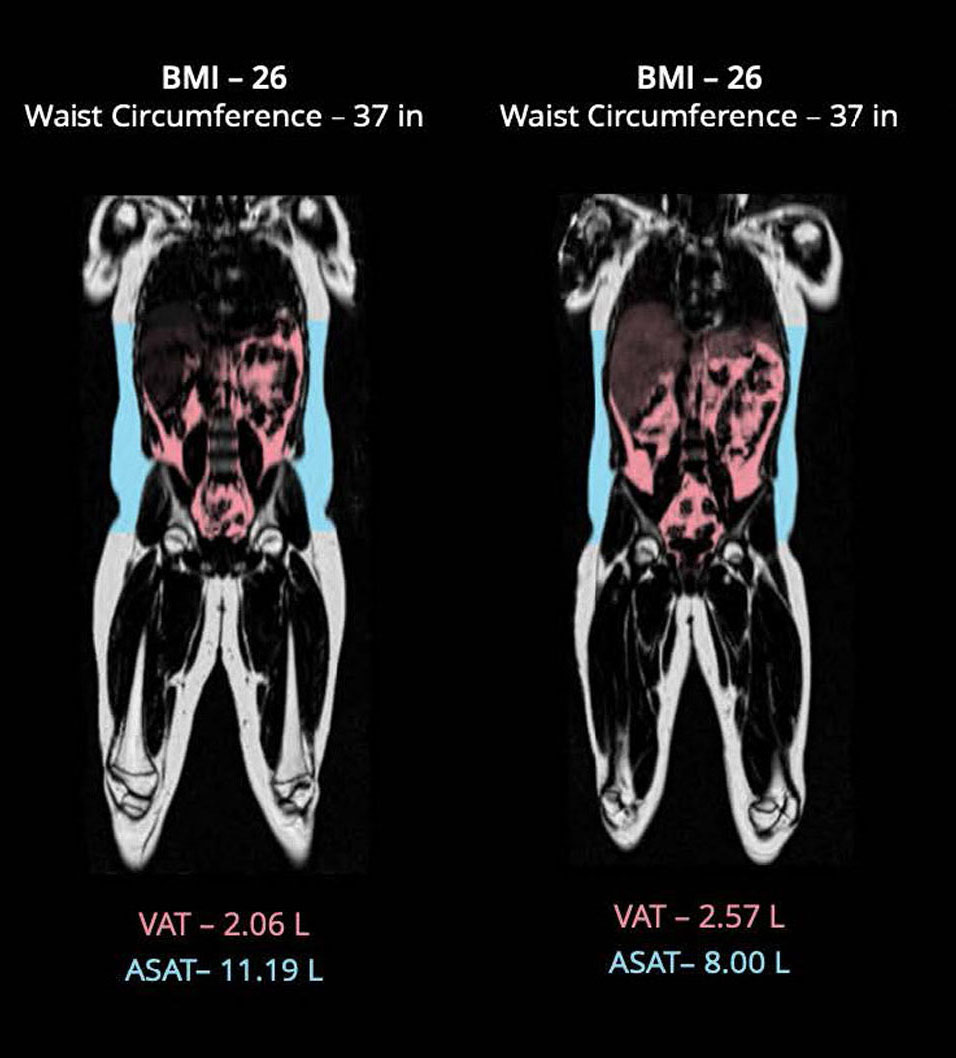Body Composition Profile with MRI - Mayfair Diagnostics