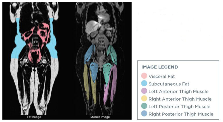 BODY COMPOSITION PROFILE MRI - Mayfair Diagnostics