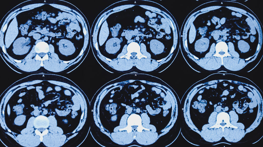 WHAT DOES COMPUTED TOMOGRAPHY MEAN? - Mayfair Diagnostics